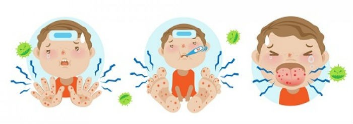 Enteroviroza - simptomi, liječenje i kako ju izbjeći? - MaminSvijet.hr