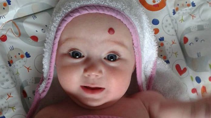 Hemangiom - što je, zašto se pojavljuje i zahtjeva li liječenje ...